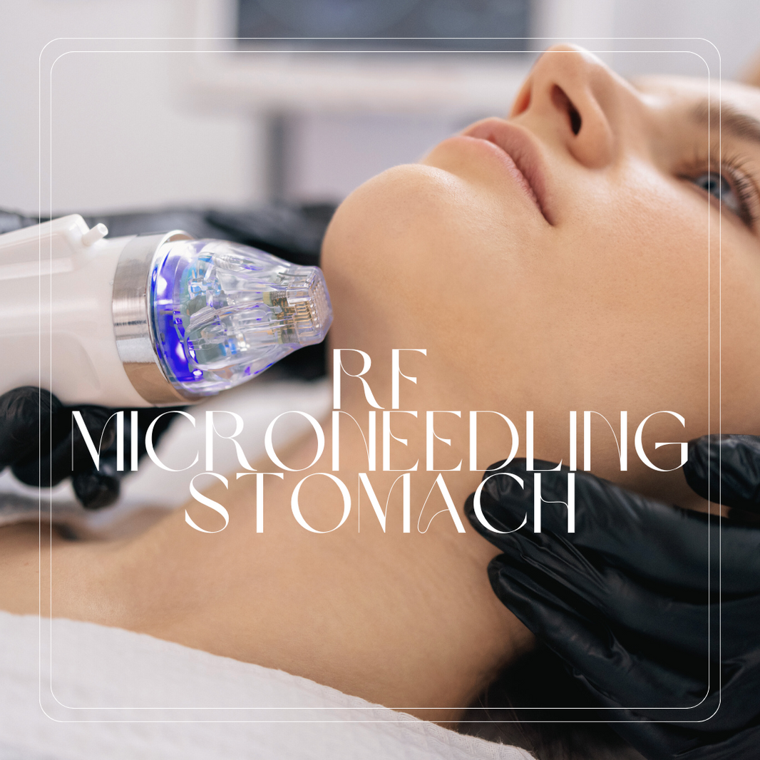 RF Microneedling – otaniskin