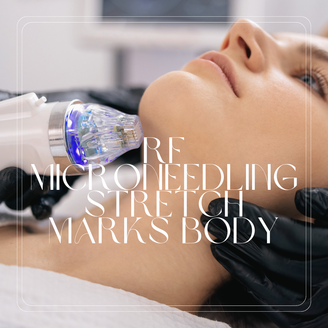 Rf Microneedling Stretch Marks On Body Otaniskin